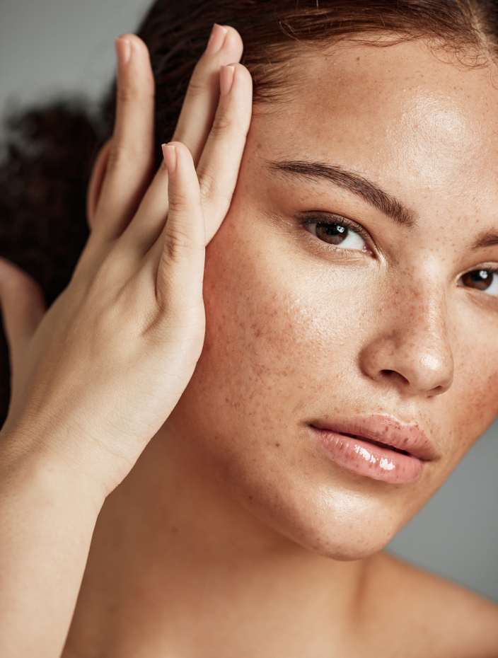 Stretch Mark Removal - Supriya Dermatology